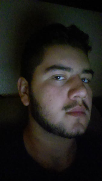 Why is one side of my face bigger than the other? (Photo) Doctor ... Why is one side of my face bigger than the other? (Photo) Doctor ...