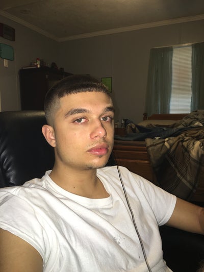 One side of my face is noticeably larger than the other. Can you tell ... One side of my face is noticeably larger than the other. Can you tell ...