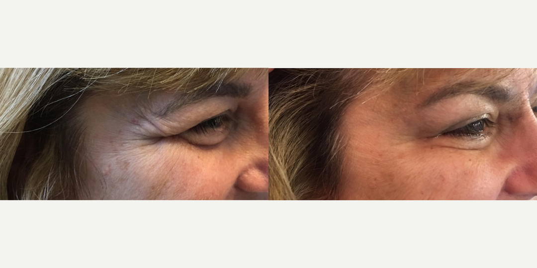 ashpole plastic surgery