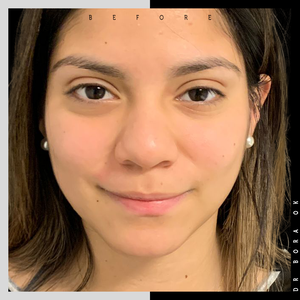 Bora Plastic Surgery