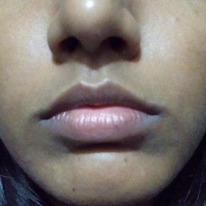 Fat Lower Lip