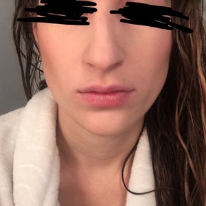 What Is An Italian Nose