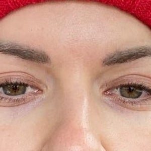 upper eyelid folding over