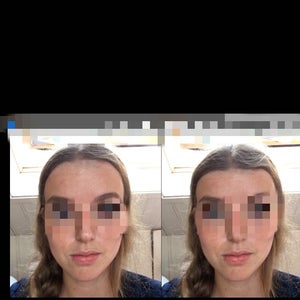 world's smallest forehead