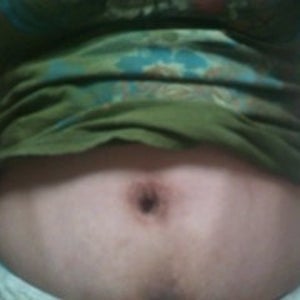 pigmentation around belly button