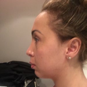 big face small features