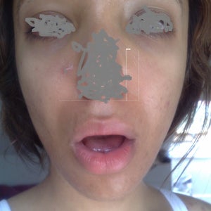 face cheeks sinking in