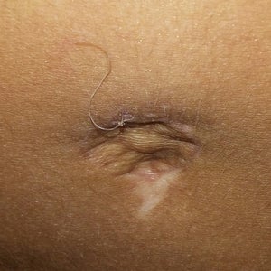 stitch belly button piercing