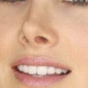 right side face dropped