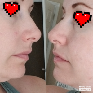 different nose profiles