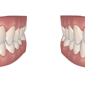 are black triangles normal