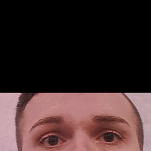 does adderall make your face puffy