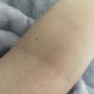 line in arm