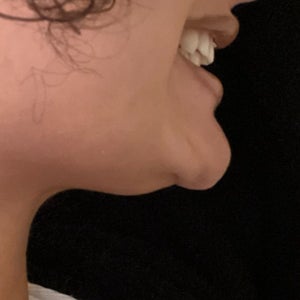 what does chin down mean