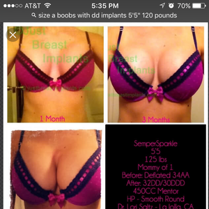 D Cup Breast Implants Before And After