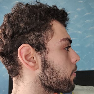 longer lower third face