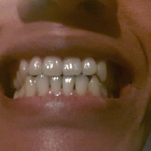 are small teeth ugly