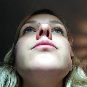 upturned nose frequency