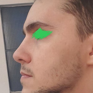 nordic nose side profile