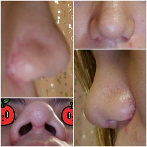 nostrils change shape