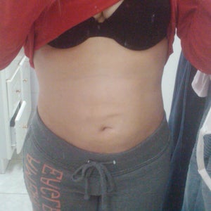 Fatty Lumps In Abdomen