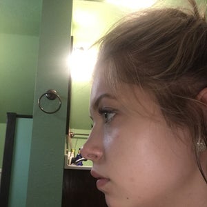 weak chin fixes