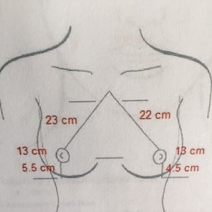 38a breast example