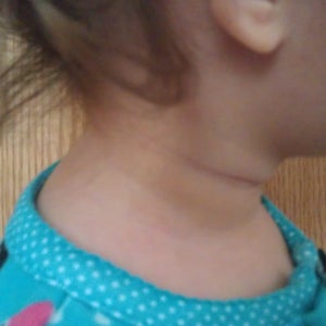 newborn chubby neck