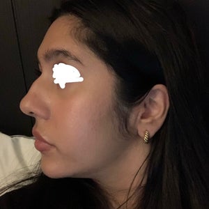 different nose side profiles