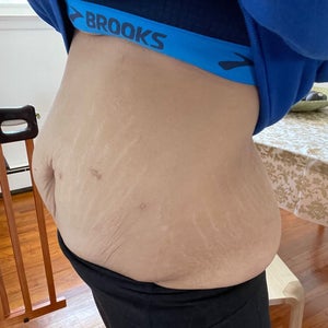 why does my belly extend