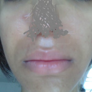 face cheeks sinking in