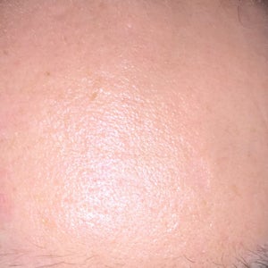 Orange Skin Texture Bump