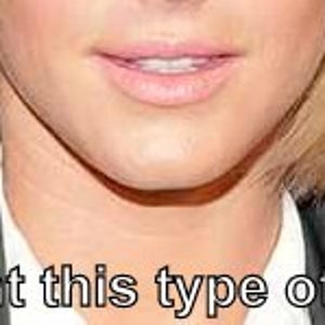 cleft chin face shape