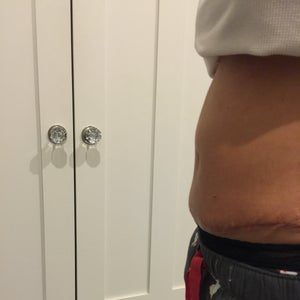 inside belly button feels hard