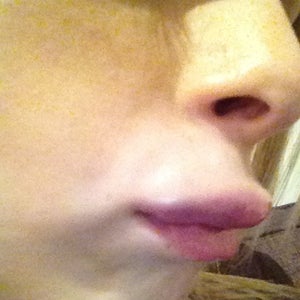 normal lip piercing swelling