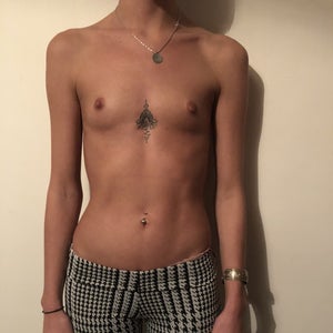 32aa breast augmentation