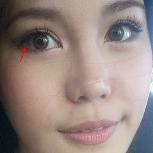 dawn yang before plastic surgery