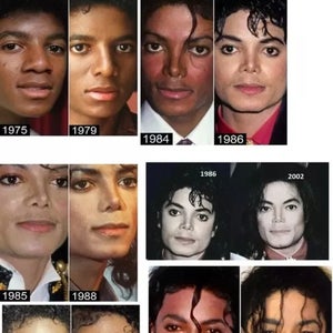 michael jackson nose broken