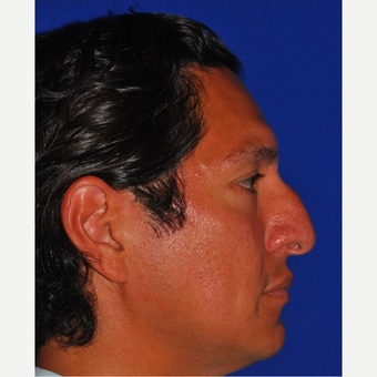 Nose Side View