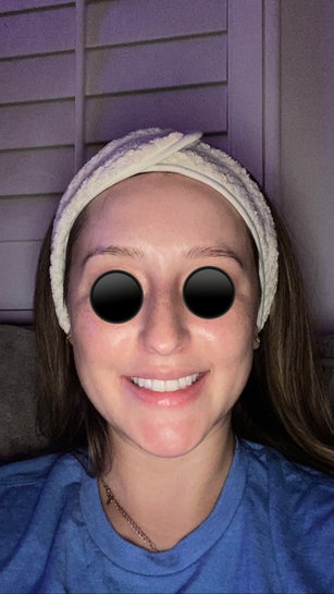 Coraline Button Eyes Costume