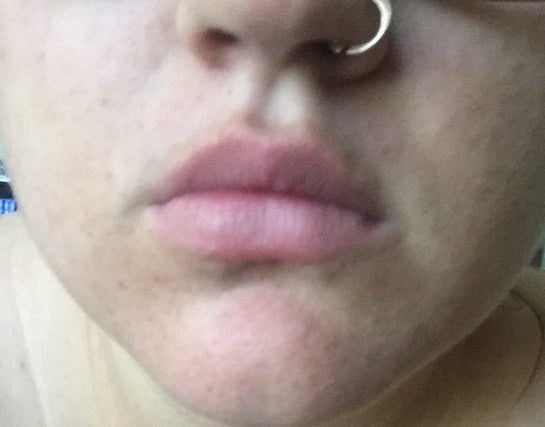 Why Does My Top Lip Curl Up - Infoupdate.org