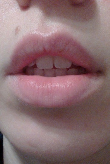 Droopy Lips | Lipstutorial.org