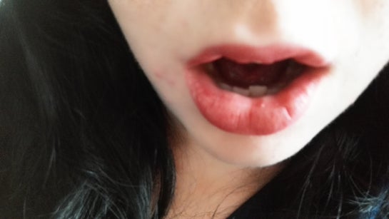 Bleeding Lips Tumblr