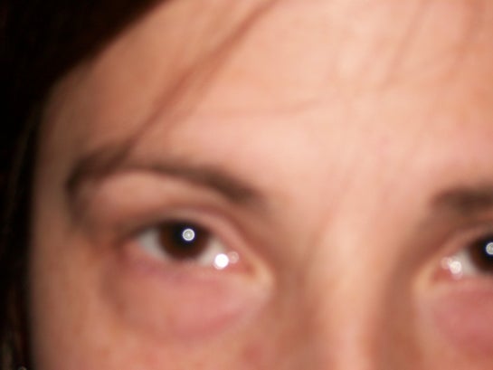 Slanted Eyes Caucasian