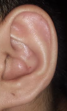 Industrial Piercings Gone Wrong