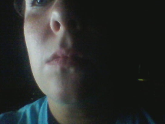 Bumps Under Lower Lip