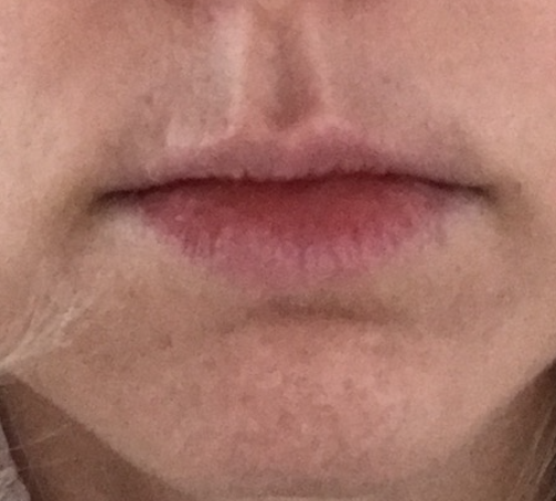 Blue Tinge To Lips | Lipstutorial.org