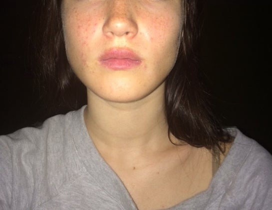 Mouth Too Small