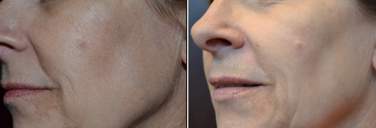 Jessica Krull's Instagram, Twitter & Facebook on IDCrawl