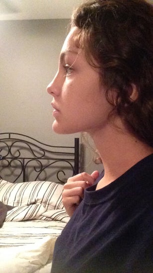 Chin That Sticks Out